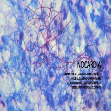 Nocardia | PPTX