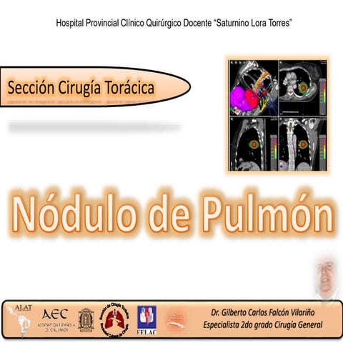 Cancer de pulmon guatemala | PPTX