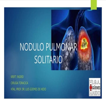 Nodulo pulmonar Nodulo pulmonar Nodulo pulmonar | PPTX