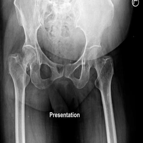 Nof fixation sequence | PPT