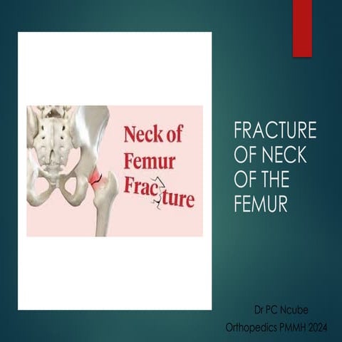Fracture neck of femur | PPTX