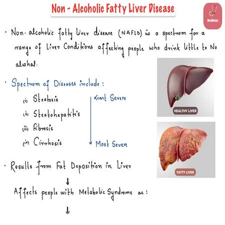 Non - Alcoholic Fatty Liver Diseases.pdf