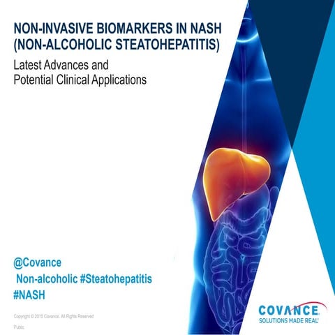 Non Invasive Biomarkers in NASH (non-alcoholic steatohepatitis) Webinar ...