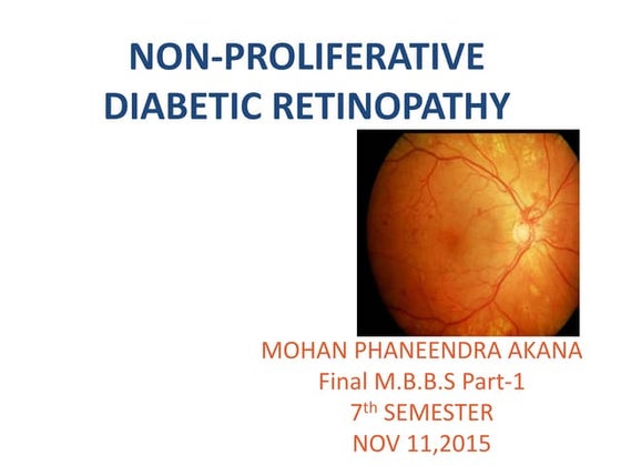 Diabetic retinopathy | PPTX