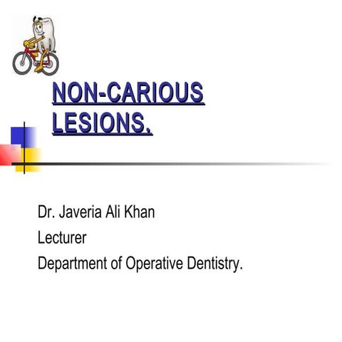 Non –carious lesion | PPTX