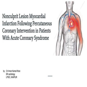 Nonculprit Lesion Myocardial Infarction Following Percutaneous Coronary ...