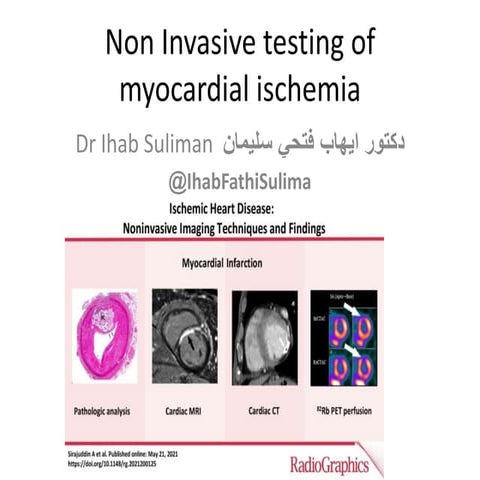Non Invasive testing of myocardial ischemia AA.pptx