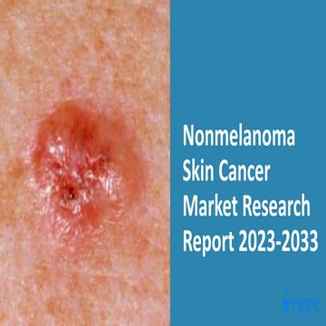 Melanoma Market 2023: Epidemiology, Industry Trends, Size, Share And ...