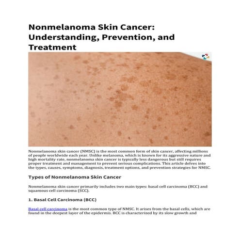 Nonmelanoma Skin Cancer: Types, Causes, Symptoms and Treatment | The ...