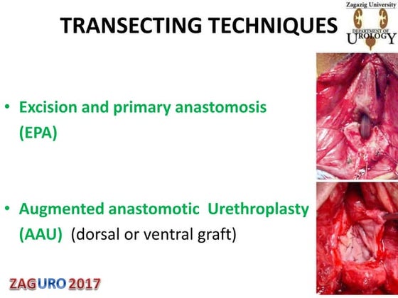 OIU review article | PPTX | Surgery | Medical Health