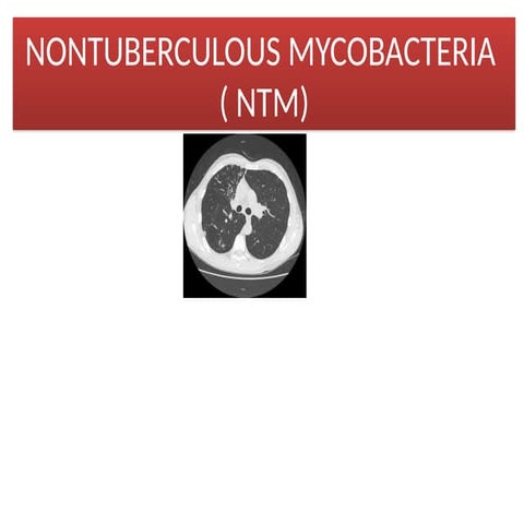 NONTUBERCULOUS MYCOBACTERIA. .pptx