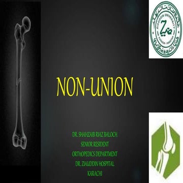 NONUNION.pptx