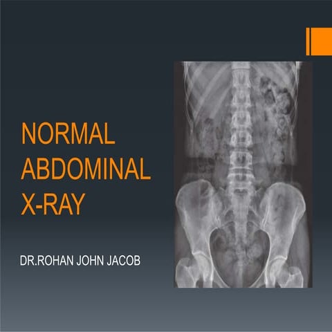 Normal abd xray rjj.pptx