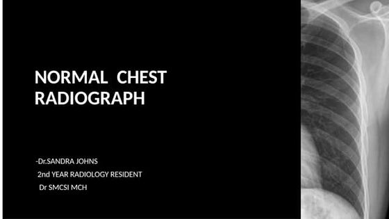 Chest radiography positioning and Technique.pptx | Death, Injury, or Military Conflict ...