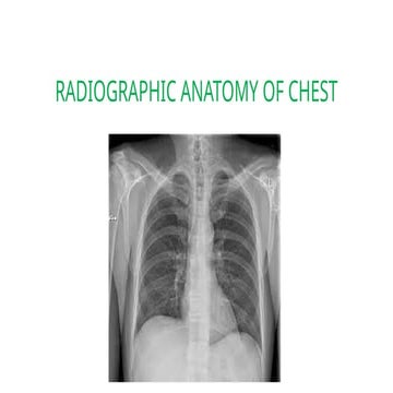 NORMAL CHEST RADIOGRAPH 23-0 7-2019.pptx