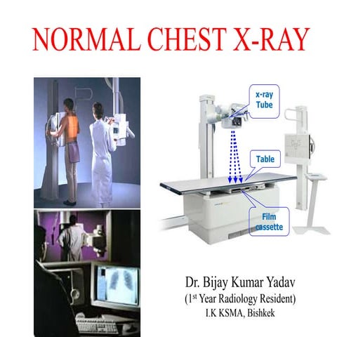 Chest X-rays for Undergraduates | PPTX