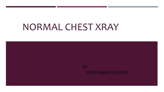 Chest xray -Lateral view radiology basics | PDF