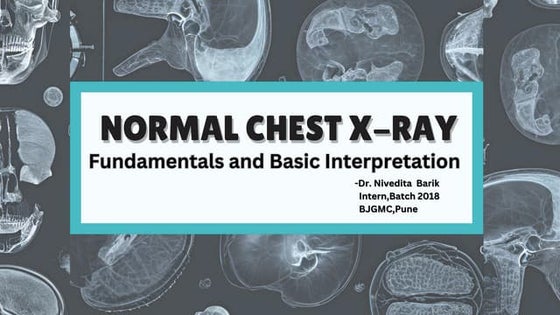 Interpretation of the paediatric chest x-ray | PDF