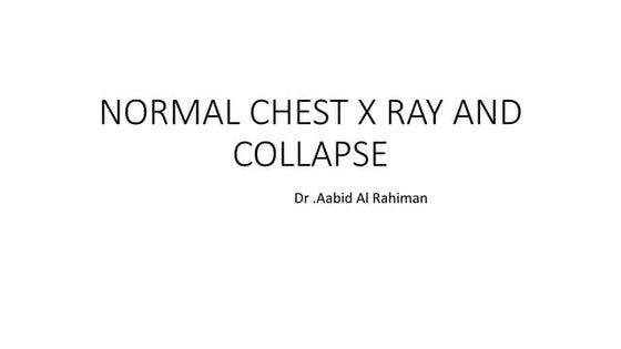 Chest xray -Lateral view radiology basics | PDF