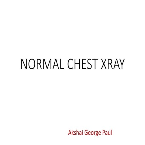 Normal cxr agp | PPTX | Lung and Respiratory Health | Diseases and ...