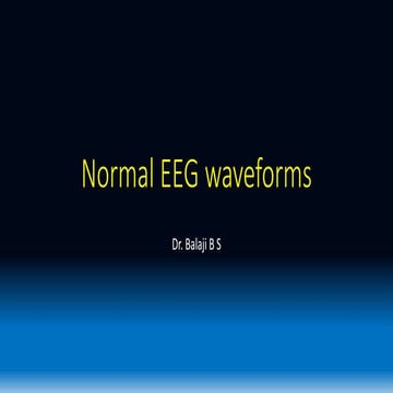 Normal Eeg Waveforms Pptx