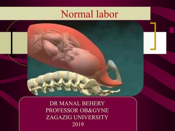 Normal labor | PPT