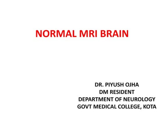 INTRA CRANIAL HEMORRHAGE- AGING BLOOD ON MRI | PPTX