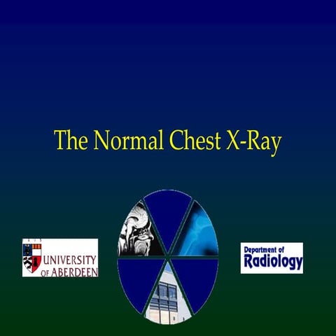 normalxray.PPT