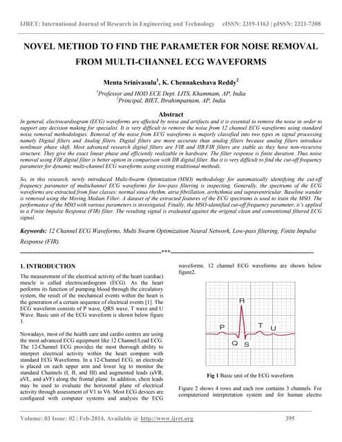 Performance Analysis Of Adaptive Noise Canceller For An Ecg Signal Ppt