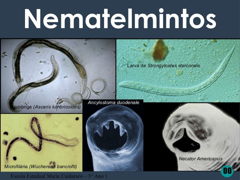 Nematelmintos