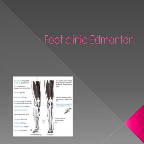 Foot clinic edmonton | PPTX