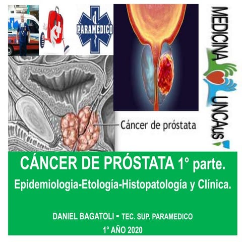 Ca de Próstata._1°_parte | PPTX