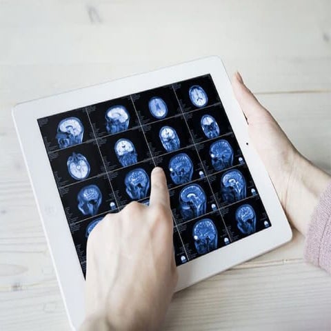 The human brain's 100 billion neurons and cells are a marvel | PDF