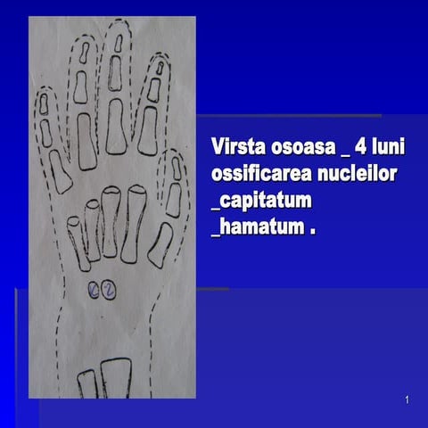 NUCLEILE de dezvoltare la copii pina la 18 ani | PPT