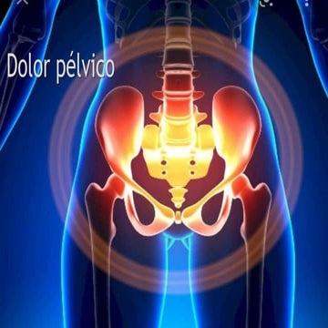 DOLOR_PELVICO_EXPOSICION SIMPLIFICADA.pptx