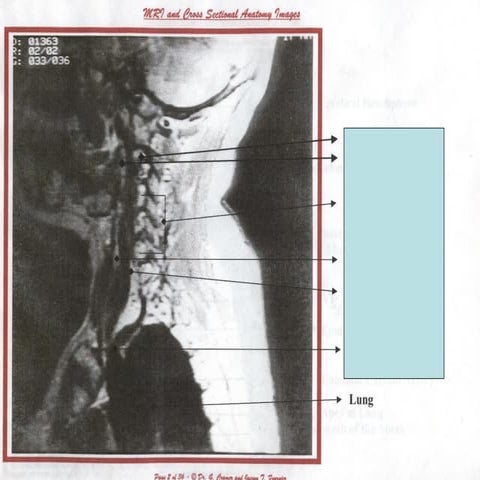 NUHS (NCC) Tri1 MRI Anatomy | PPT