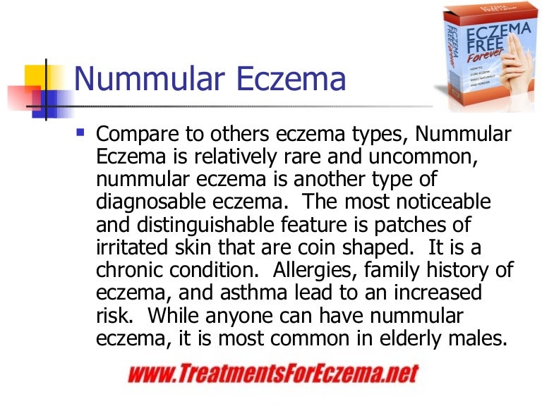 Nummular Eczema