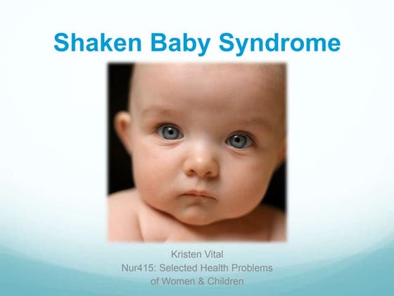 Shaken baby syndrome | PPTX