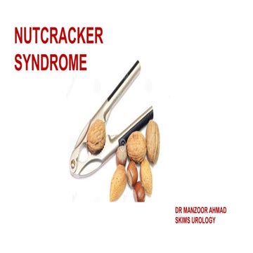Nutcracker syndrome | PPTX
