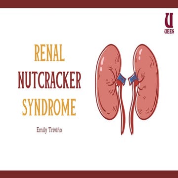 renal nutcracker syndrome presentation ET | PDF