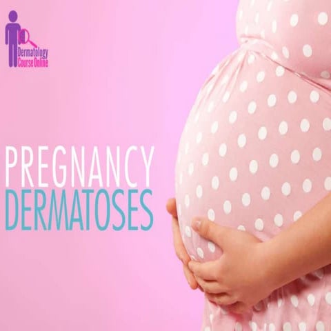 Pregnancy Dermatoses | PPTX