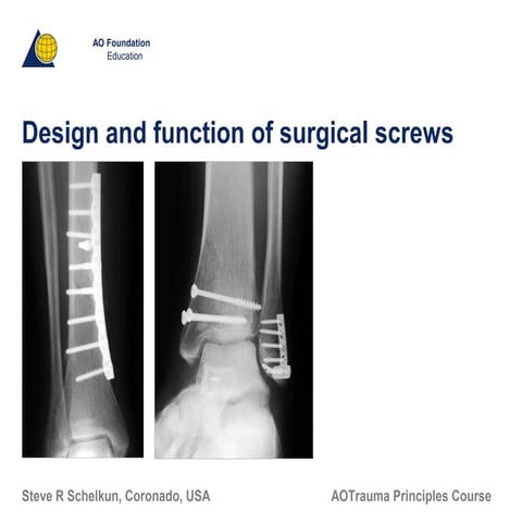 Design and function of surgical screws | PPT