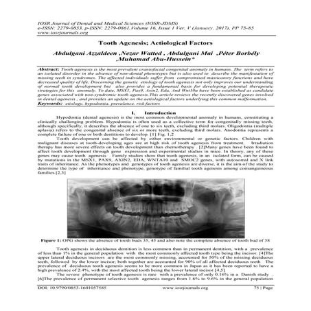 Tooth Agenesis; Aetiological Factors | PDF