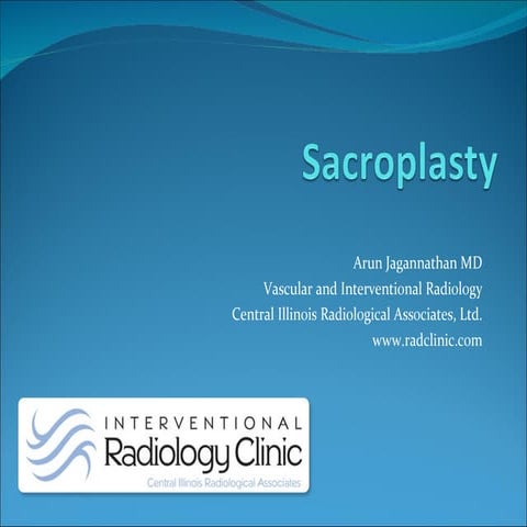 Sacroplasty Presentation | PPT