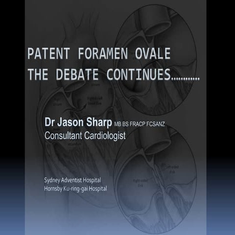 Patent foramen ovale | PPTX