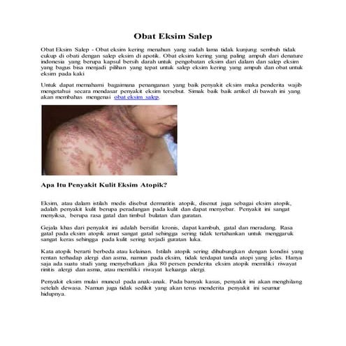 Obat eksim salep | PDF
