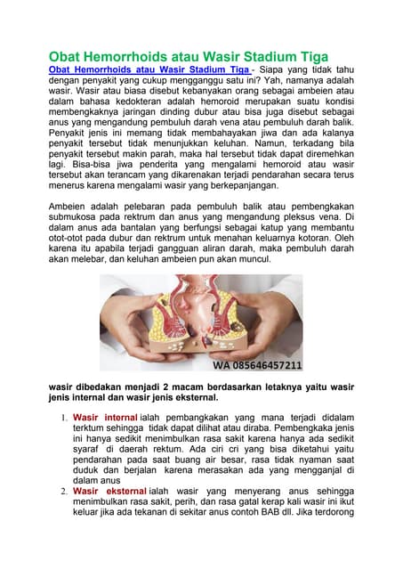 Varises pada ibu hamil slide | PPTX