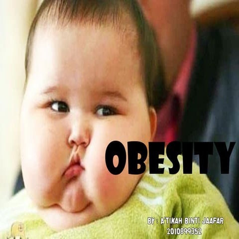 What is Obesity ? | PPTX