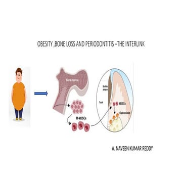 OBESITY ,BONE LOSS AND PERIODONTITIS –THE.pptx