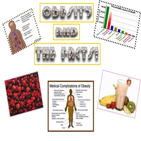 Obesity powerpoint | PPTX